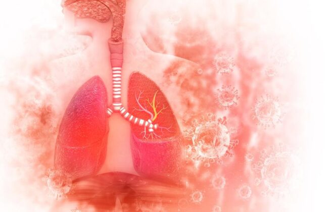 Critérios de Light diferenciam Derrame Pleural exsudativo de ...