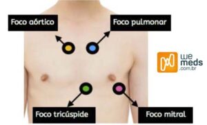 Insuficiência Cardíaca: identifique os sinais e sintomas | Portal WeMEDS