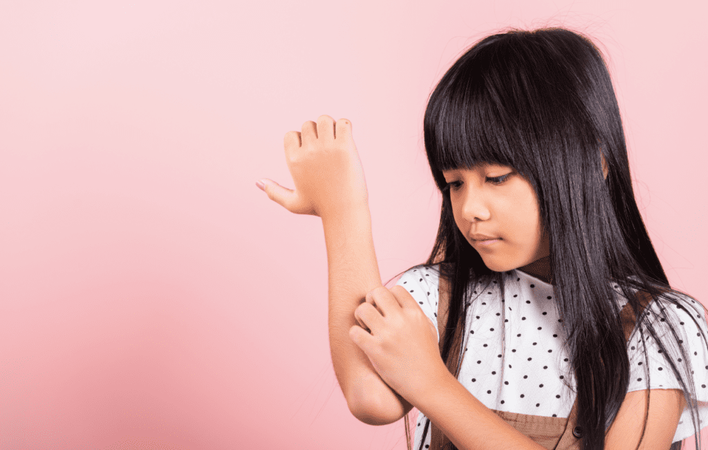 Diagnóstico e Tratamento da Tinea Imbricata | Portal WeMEDS