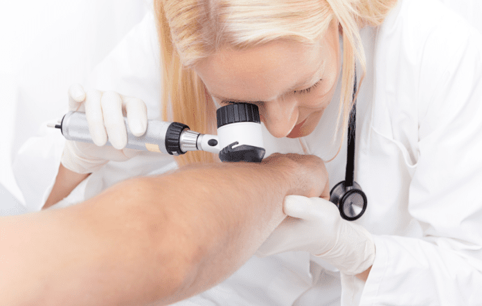 Diagnóstico e Tratamento da Tinea Imbricata | Portal WeMEDS